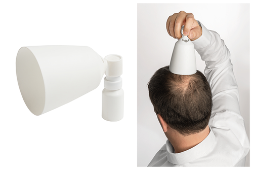 Updates – Cures for Hair Loss 2022 – Follicle Thought